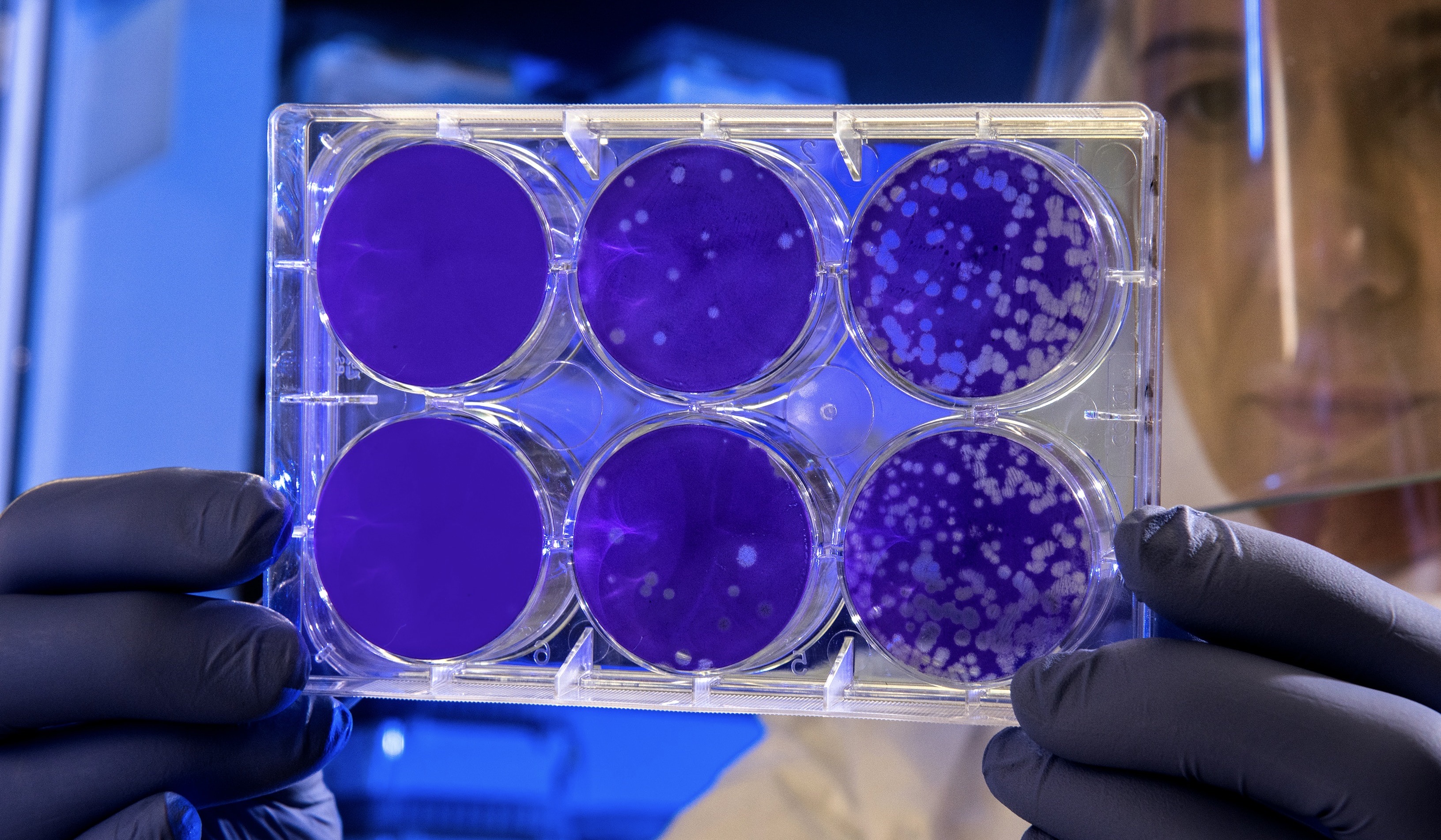 Biocompatibility for medical devices